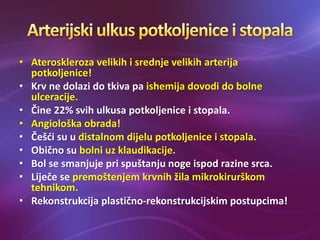 Ulkusi na donjim udovima | PPSX