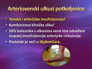 Ulkusi na donjim udovima | PPSX