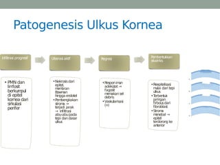 Ulkus kornea | PPT