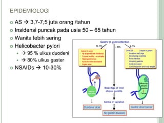 Ulkus peptikum | PPTX