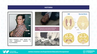 (CASO CLÍNICO DE HENRY MOLAISON) (1).pdf