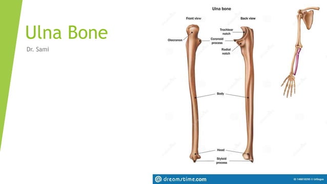 Ulna Bone Anatomy | PPTX | Death, Injury, or Military Conflict ...