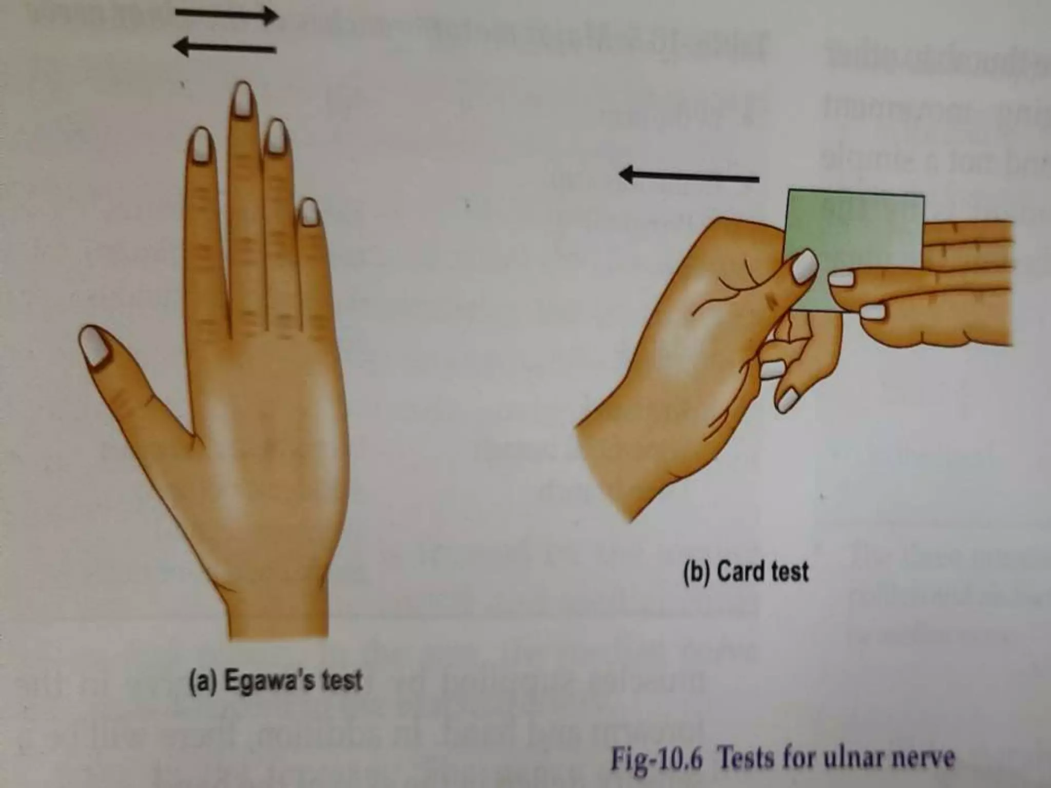 Ulnar, Accessory, Axillar, Long thoracic nerve.pptx