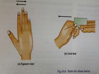 Ulnar, Accessory, Axillar, Long thoracic nerve.pptx