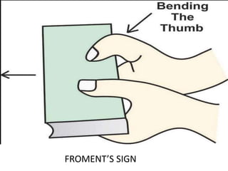 Ulnar, Accessory, Axillar, Long thoracic nerve.pptx