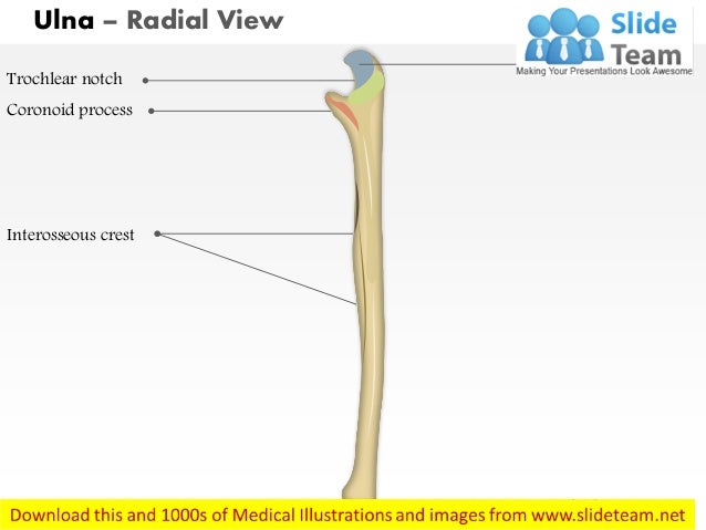 Ulna – radial view medical images for power point