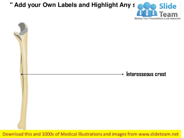 Ulna – radial view medical images for power point