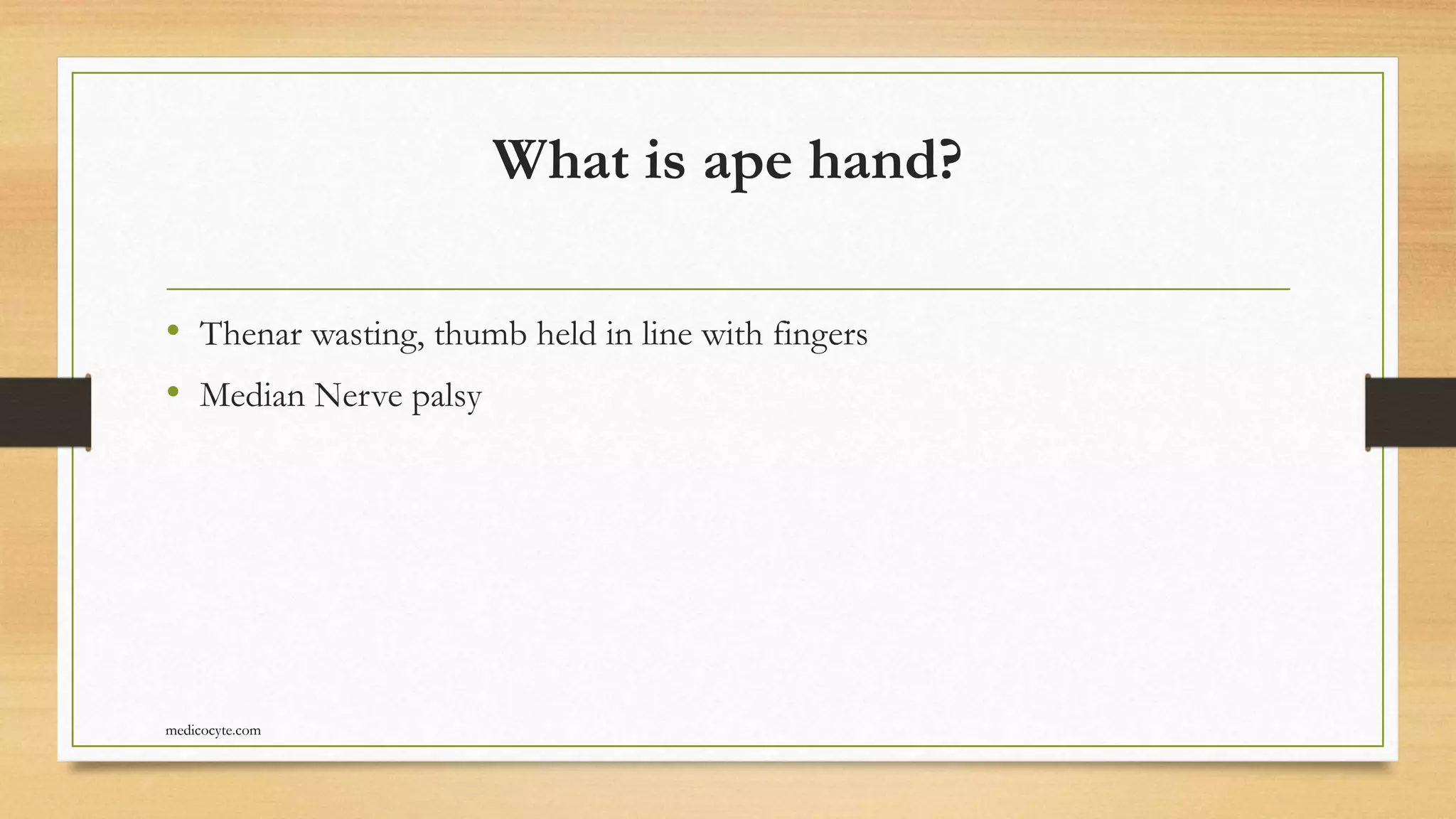 Ulnar claw and ulnar paradox by medicocyte.com