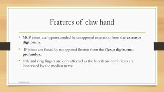 Ulnar claw and ulnar paradox by medicocyte.com