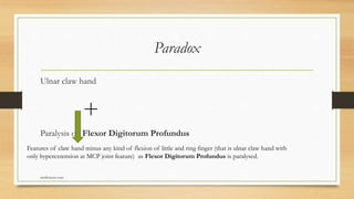 Ulnar claw and ulnar paradox by medicocyte.com