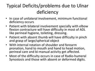 Ulnar Deficiency and Management.pptx