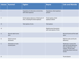 Ulnar Deficiency and Management.pptx