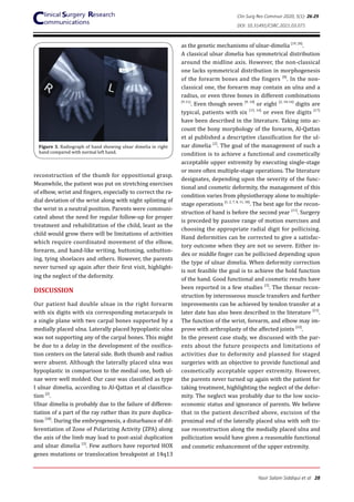 Ulnar dimelia – a rare and neglected anomaly of upper extremity | PDF