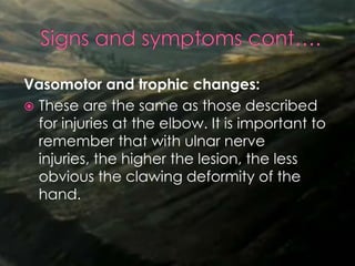 Ulnar nerve injuries | PPTX
