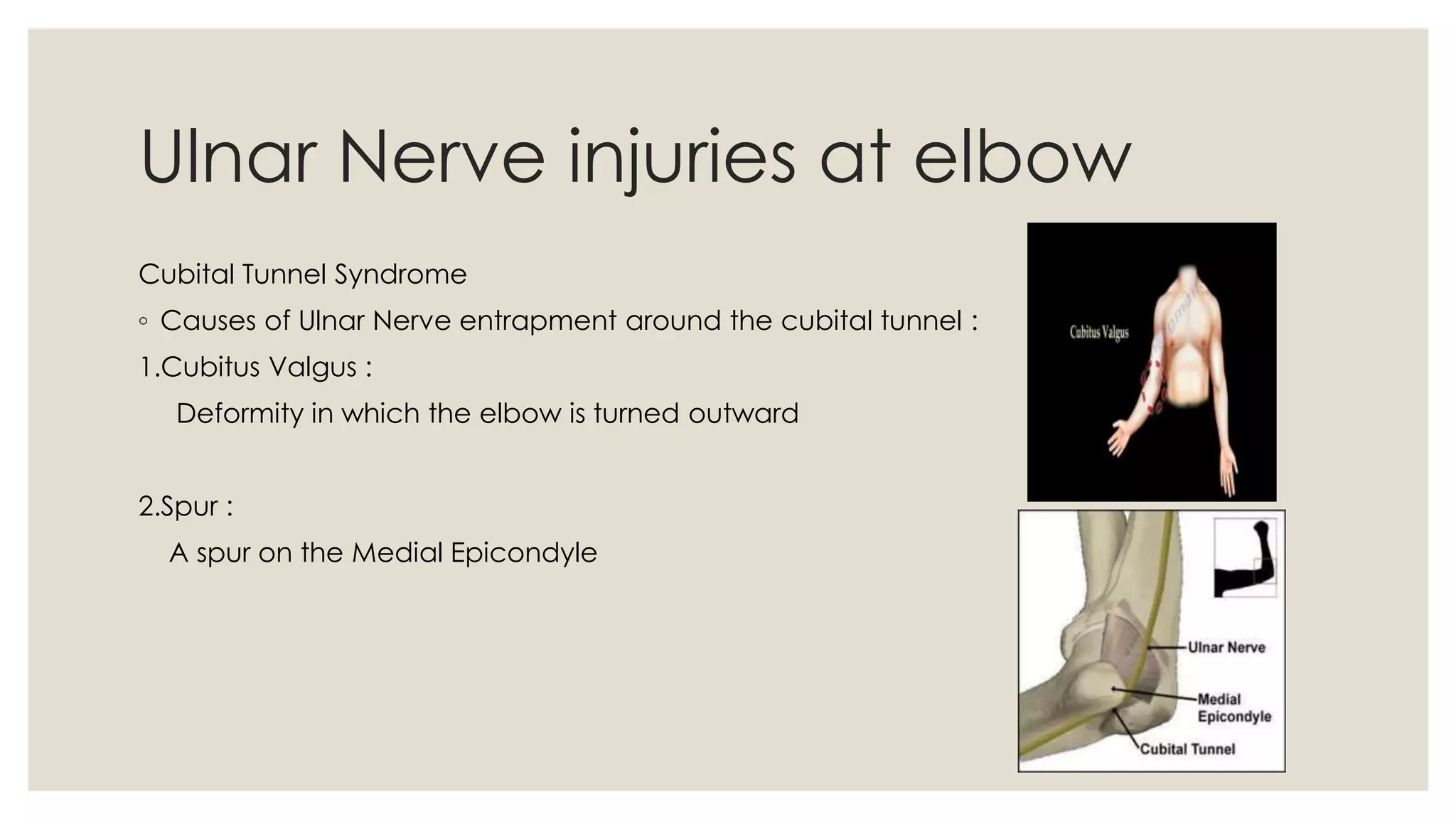 Ulnar nerve | PPTX