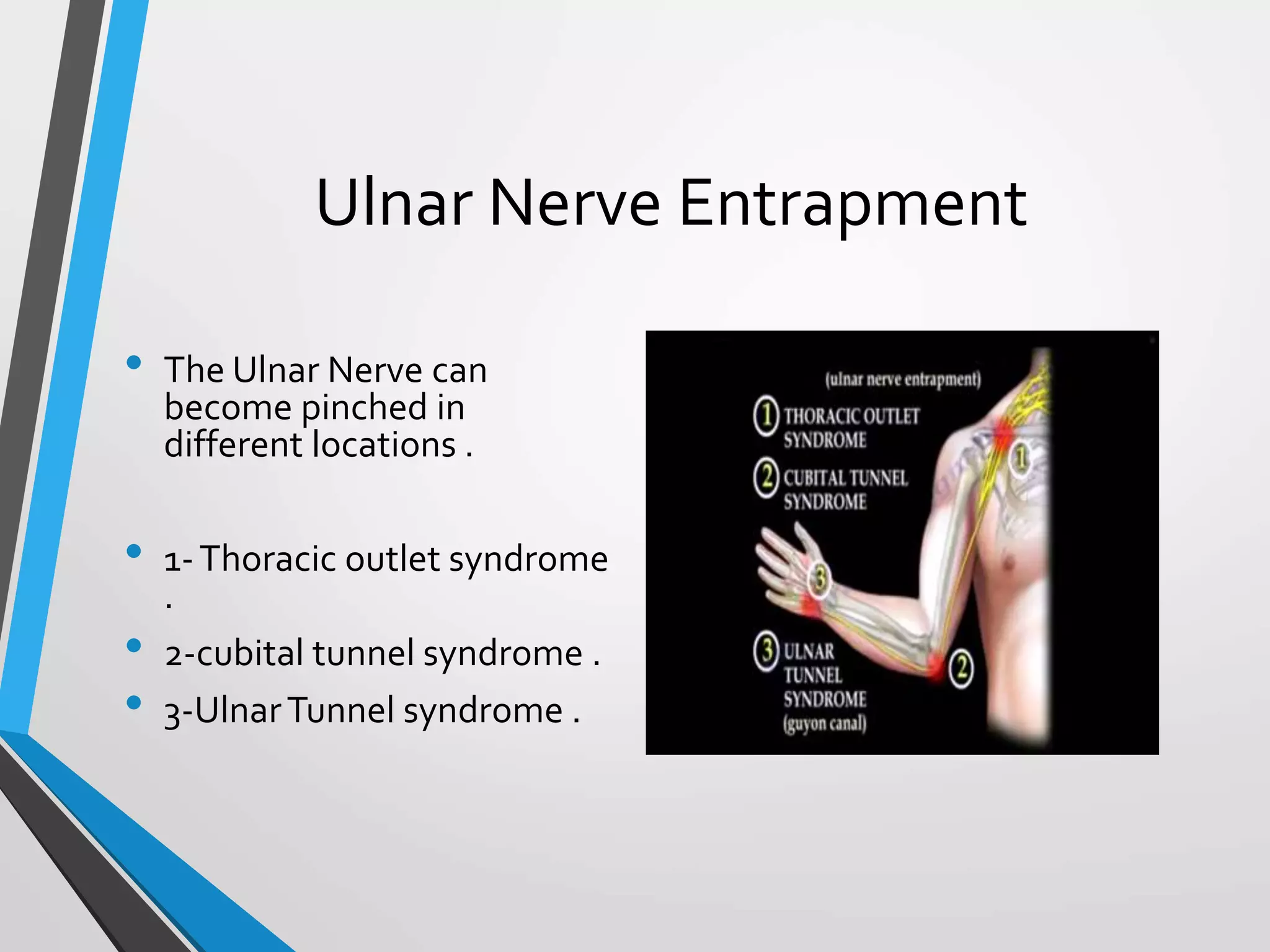 Ulnar Nerve and clinical features | PPTX