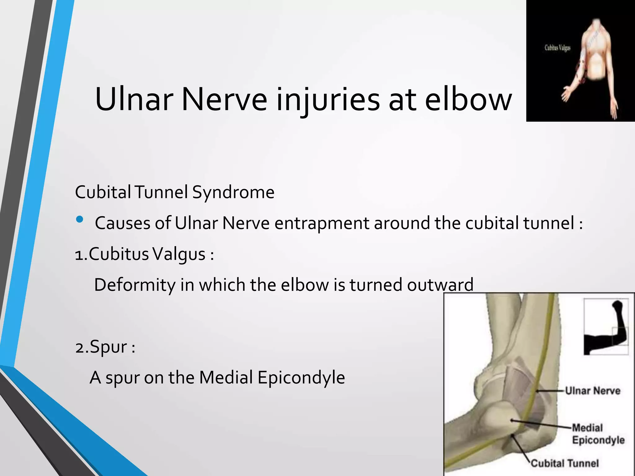 Ulnar Nerve and clinical features | PPTX
