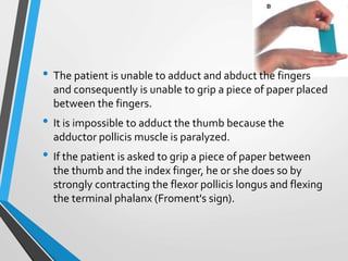 Ulnar Nerve and clinical features | PPTX