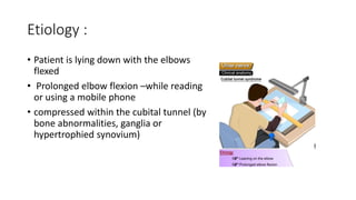 Ulnar nerve injury | PPTX