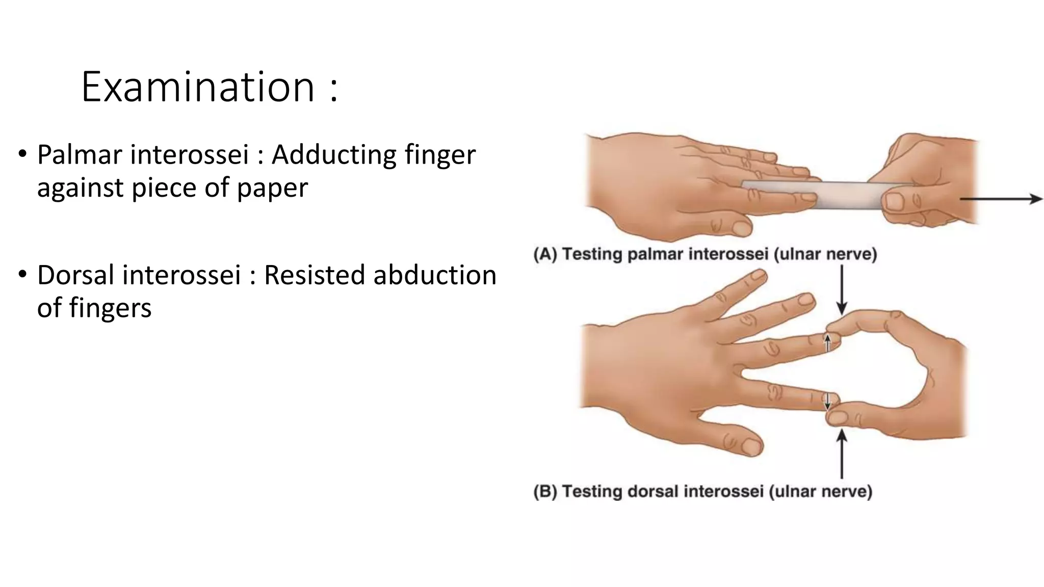 Ulnar nerve injury | PPTX