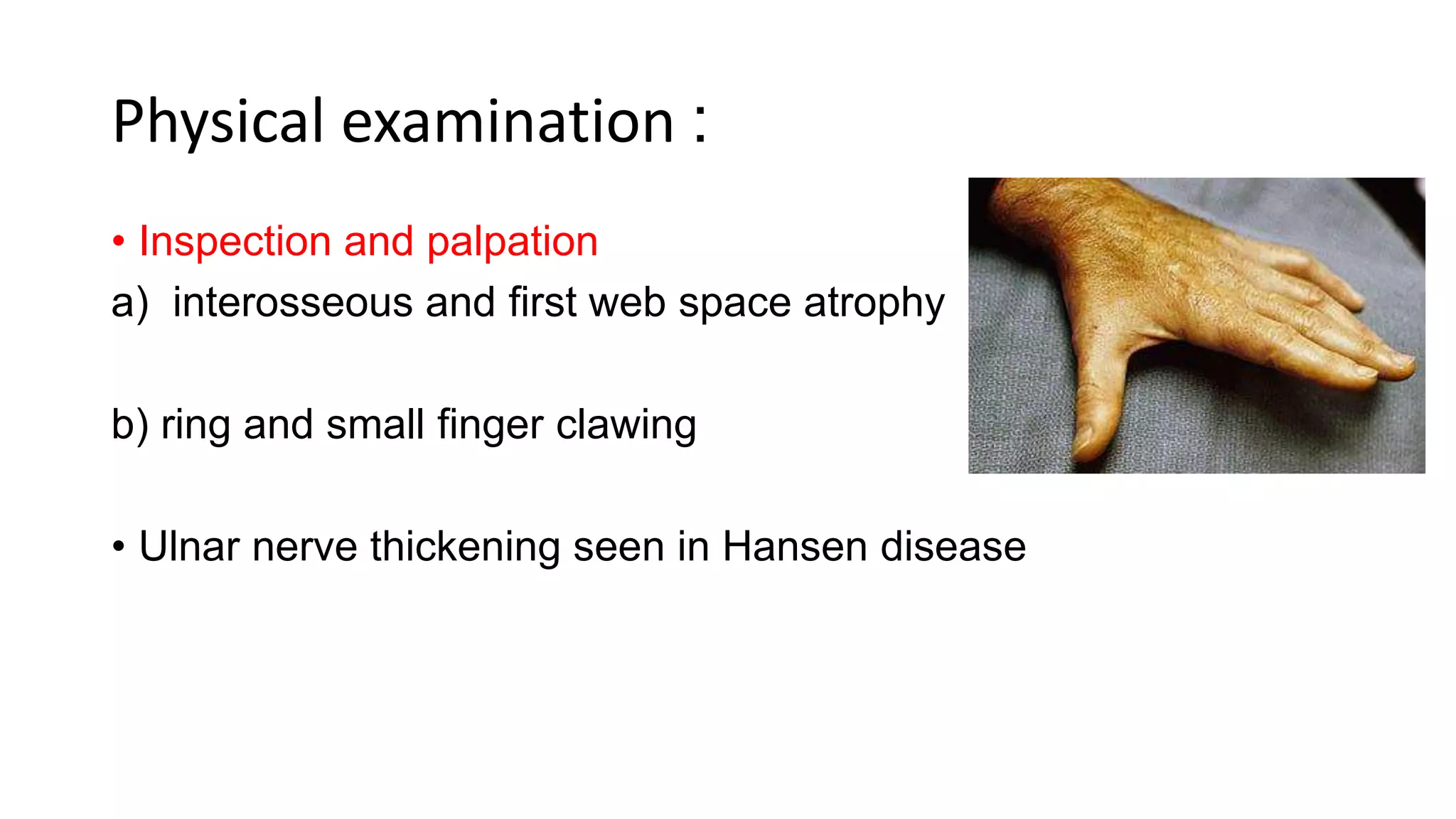 Ulnar nerve injury | PPTX