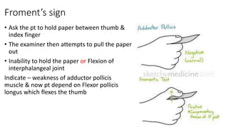 Ulnar nerve injury | PPTX