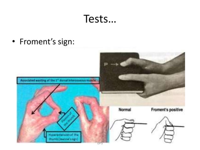 Ulnar nerve examination