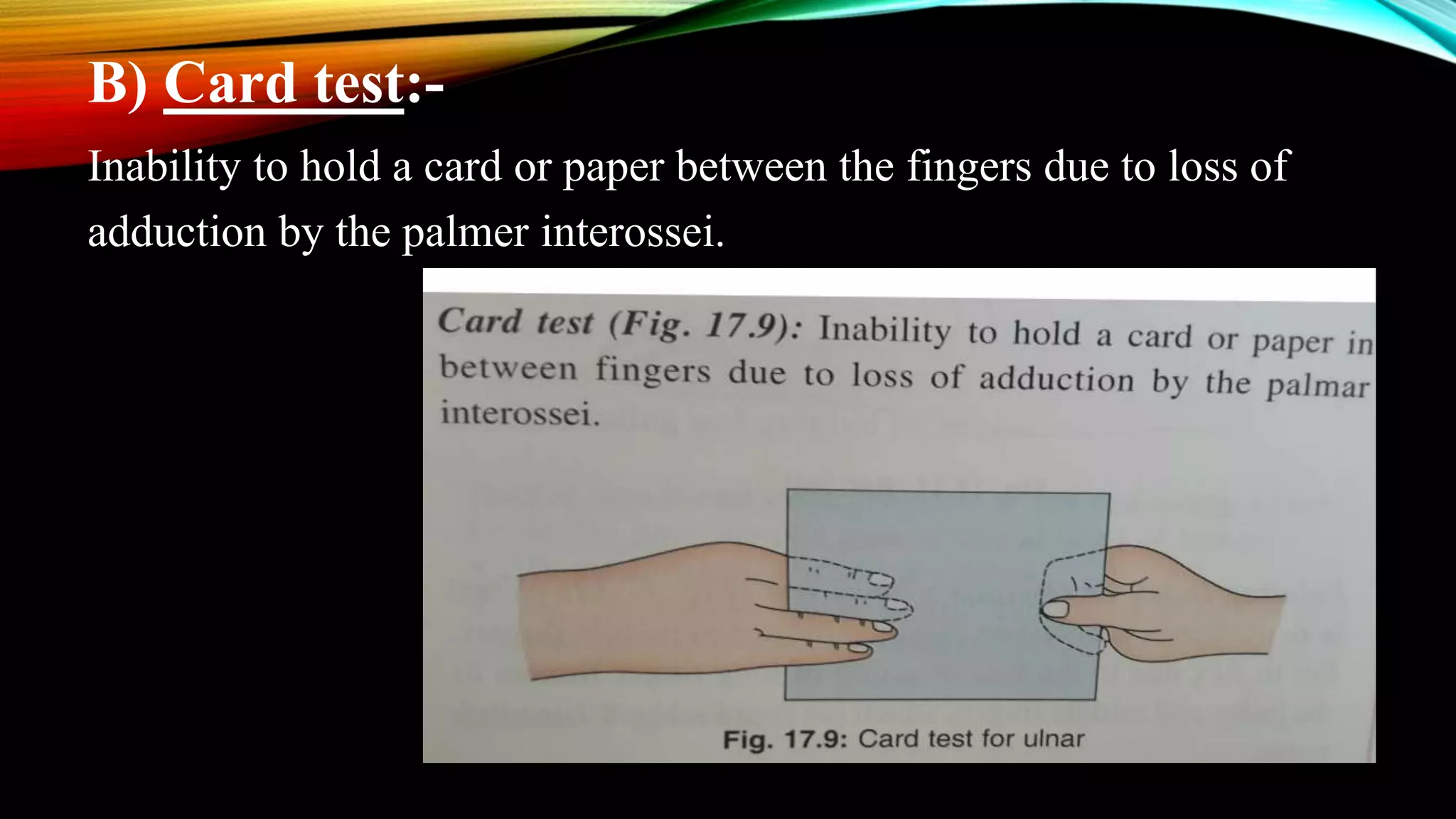 Ulnar nerve injury PPT | PPTX