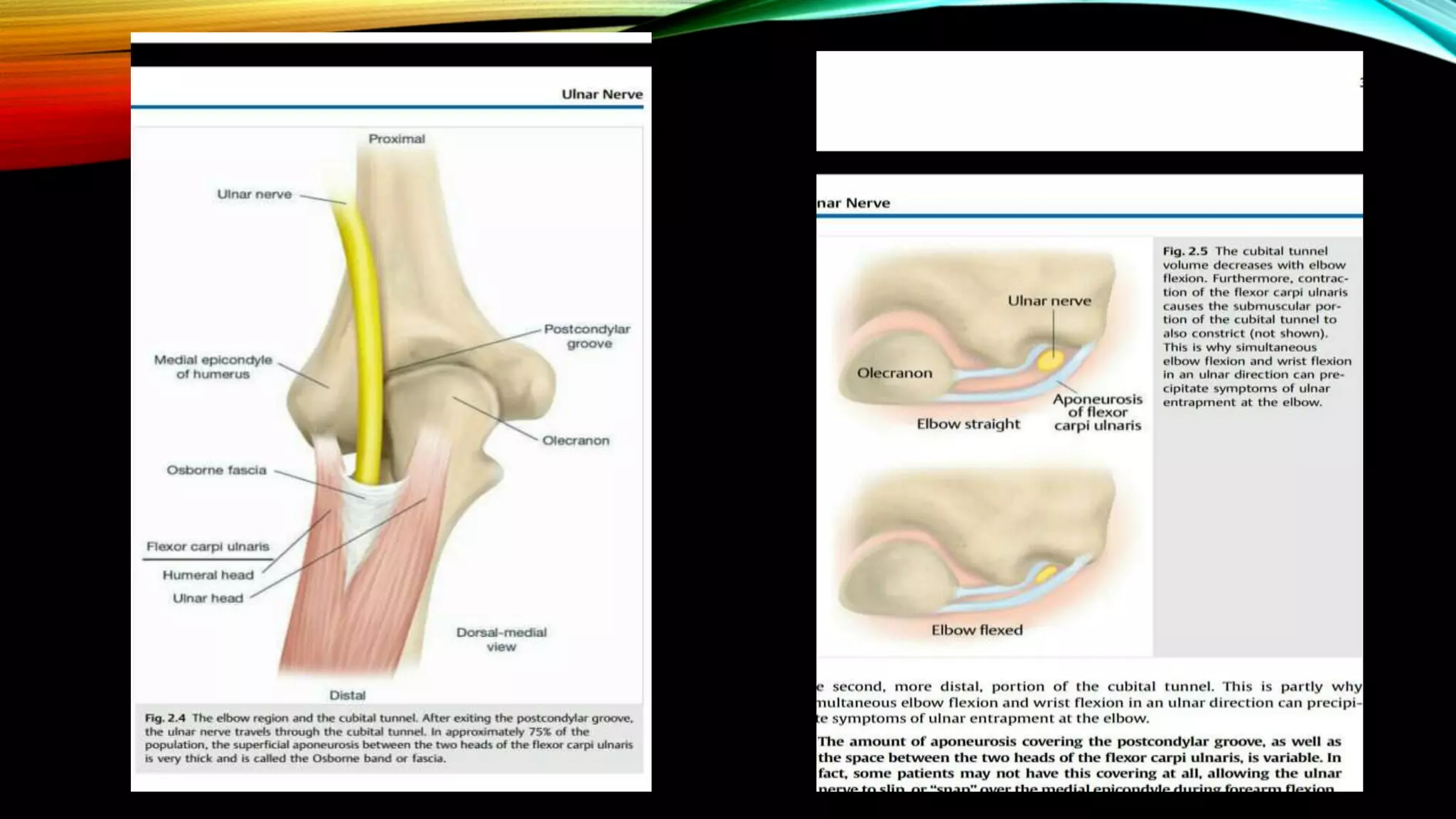 Ulnar nerve injury PPT | PPTX