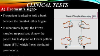 Ulnar nerve injury PPT | PPT
