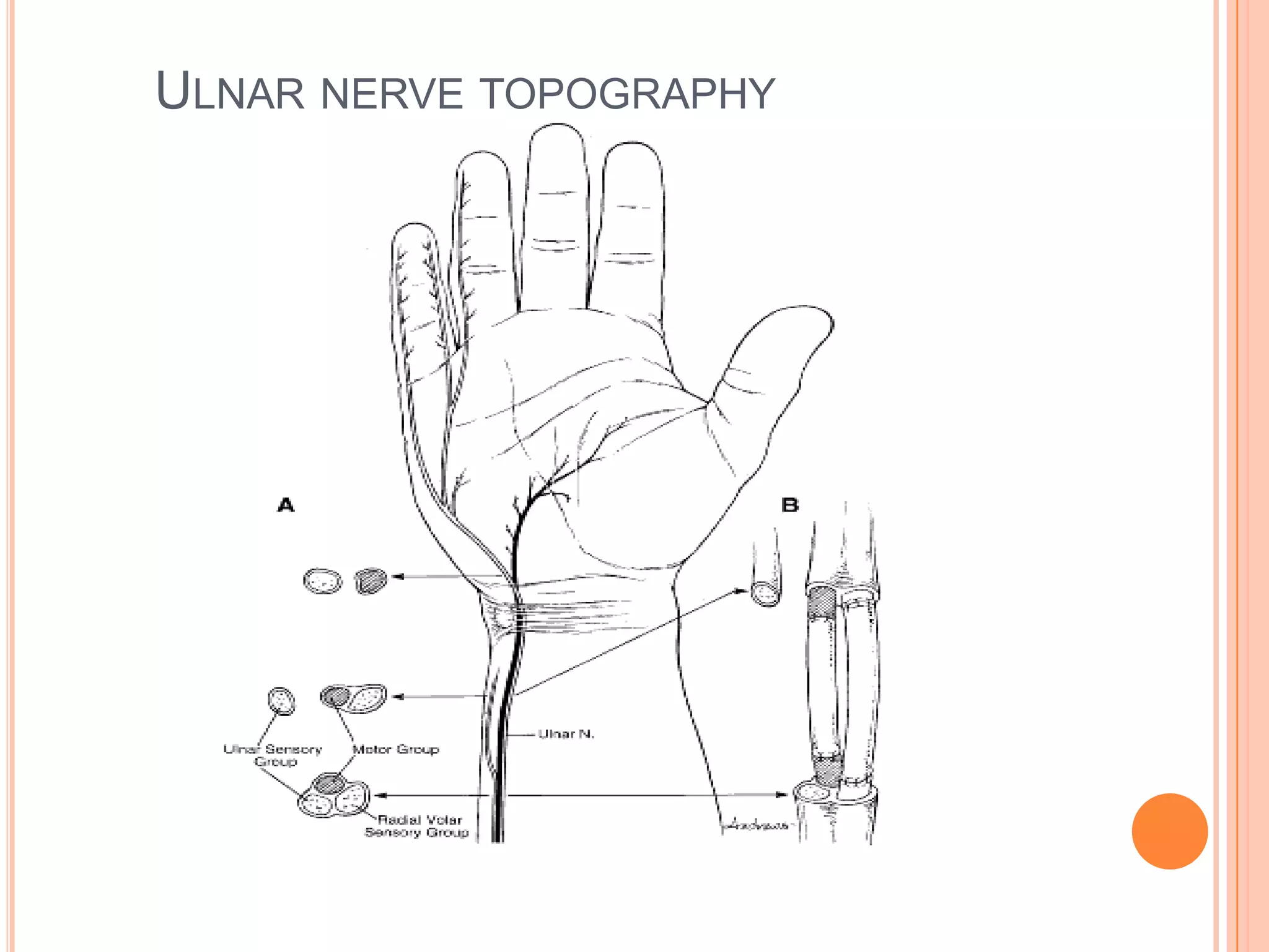 Ulnar nerve seminar | PPTX