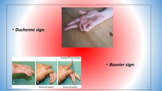 Ulnar nerve stimulation | PPTX