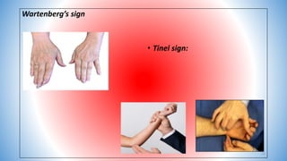 Ulnar nerve stimulation | PPTX