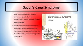 Ulnar nerve stimulation | PPTX