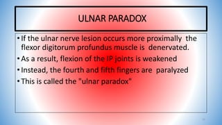 Ulnar Paradox
