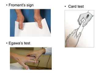 Egawa Test #ulnar #dorsal #interossei Median Nerve, Ulnar, 44% OFF