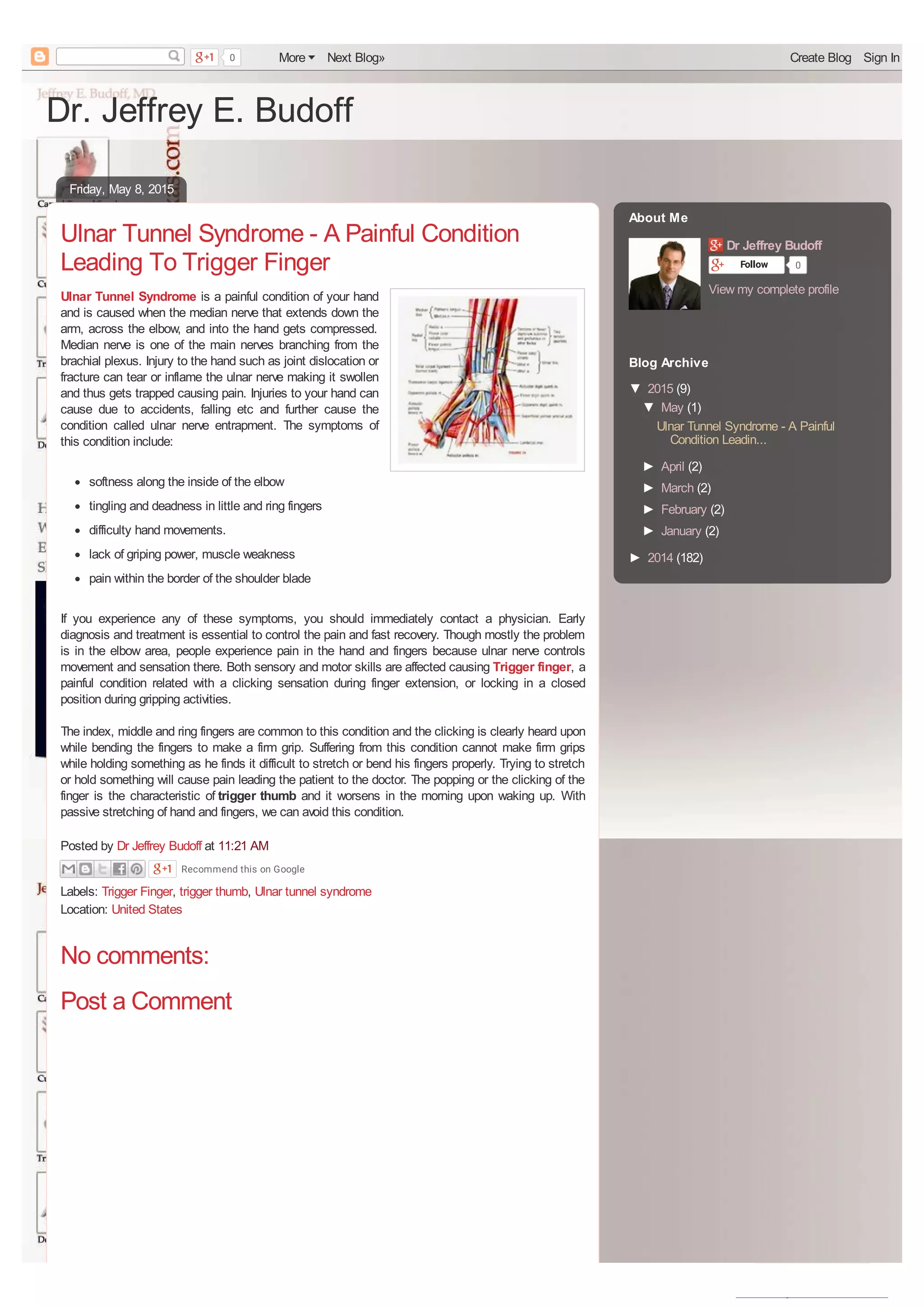 Ulnar Tunnel Syndrome - A Painful Condition Leading To Trigger Finger | PDF