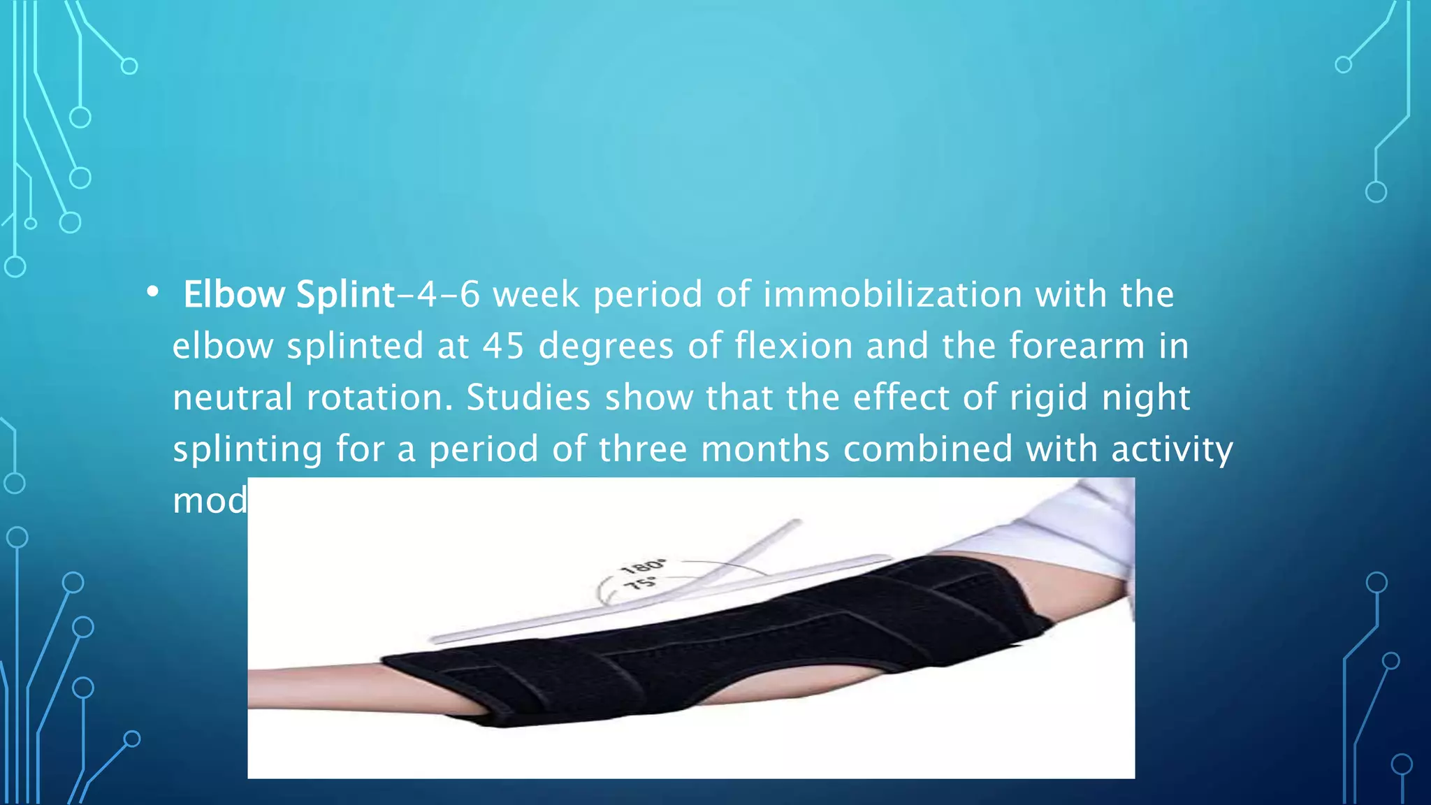 Ulnar Tunnel Syndrome (Cubital Tunnel Syndrome).pptx