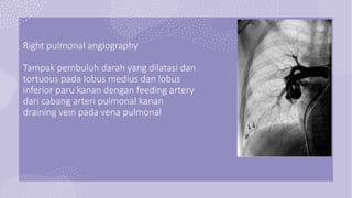 Ulok Intervensi - Silvia.pptx