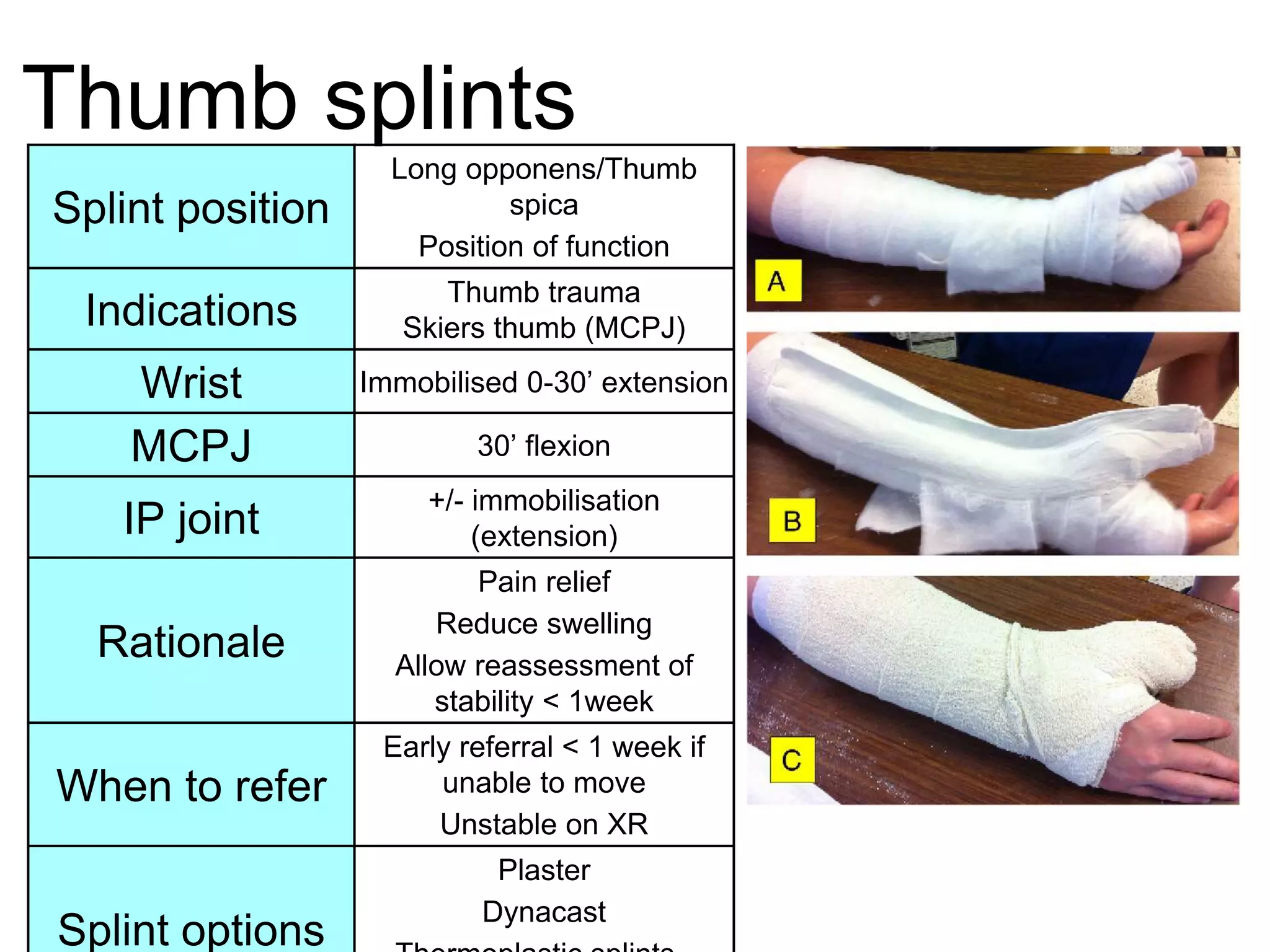 Upper limb splinting workshop | PPTX