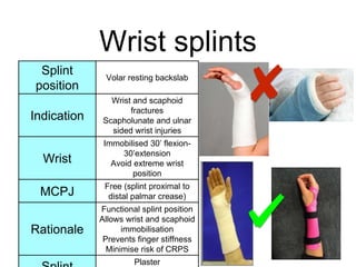 Upper limb splinting workshop | PPTX