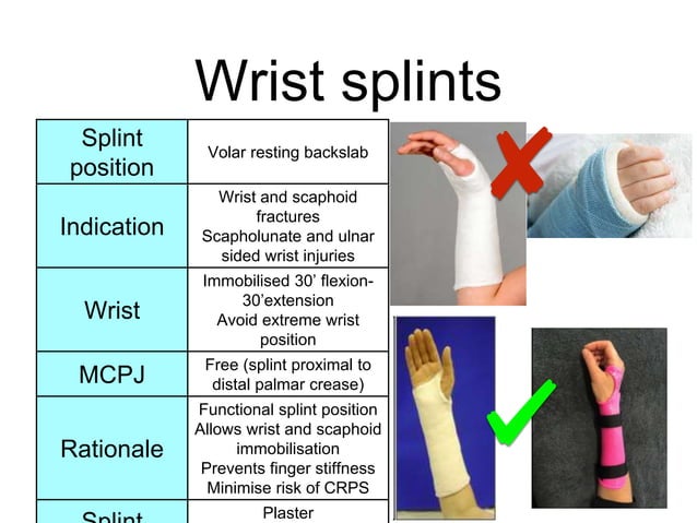 Upper limb splinting workshop | PPTX