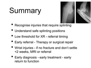 Upper limb splinting workshop | PPTX
