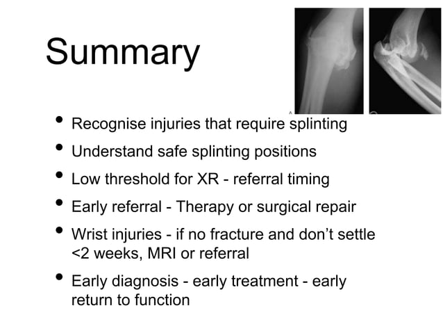 Upper limb splinting workshop | PPTX