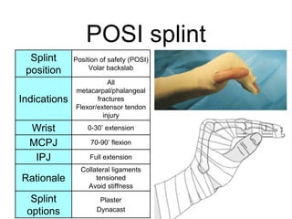 Upper limb splinting workshop | PPTX