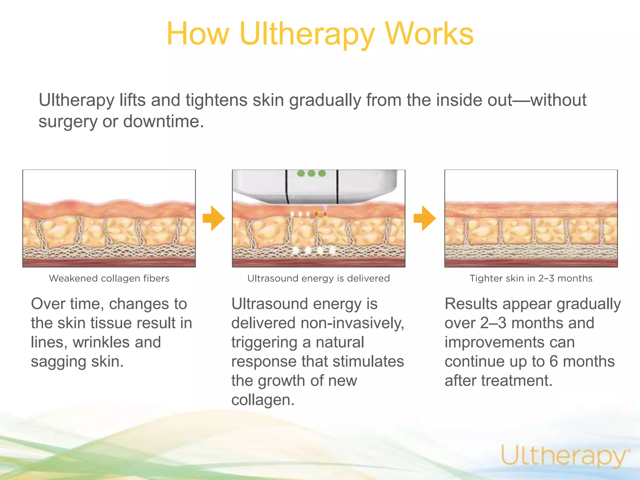 Ultherapy.slides | PPTX