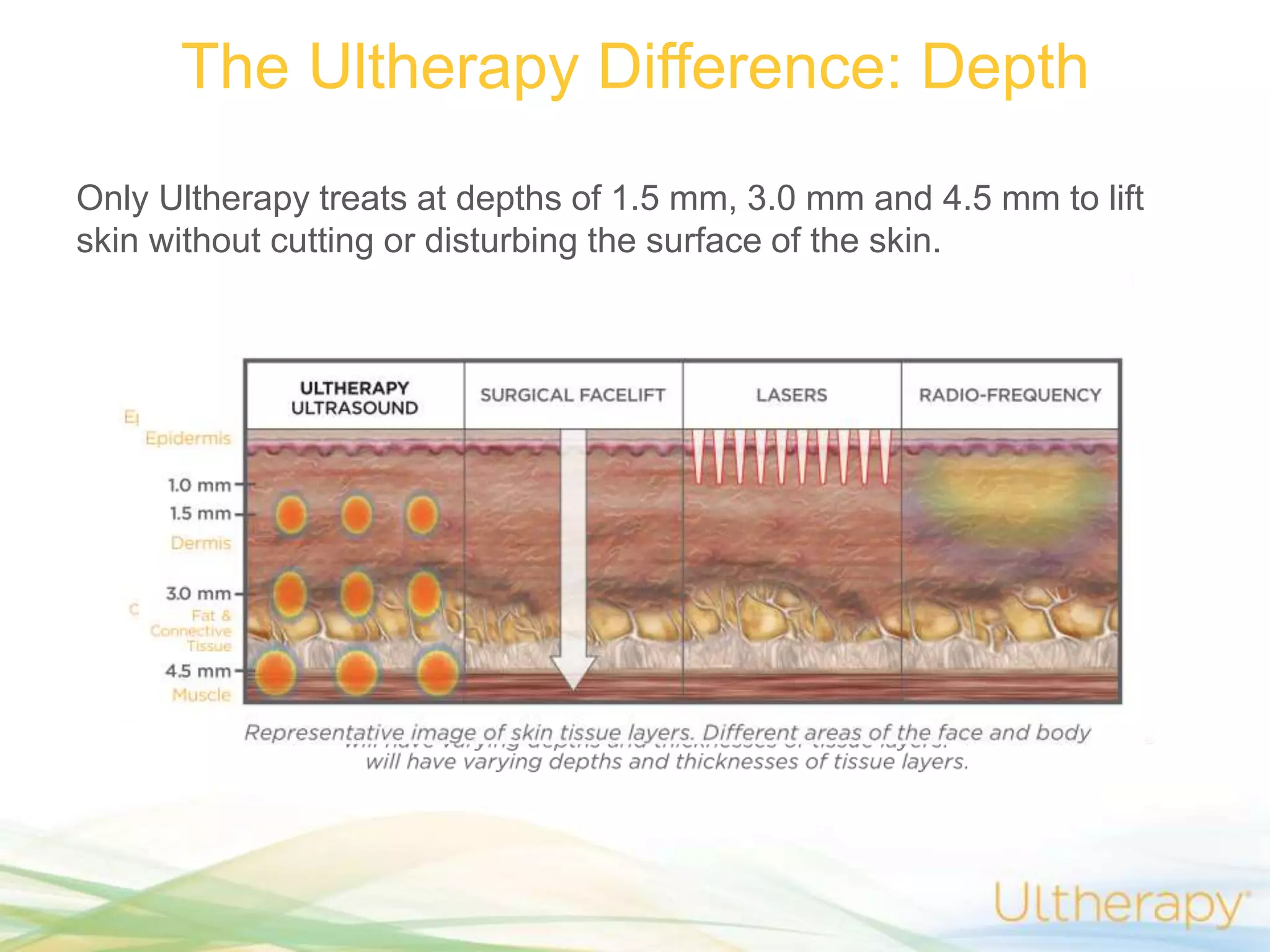 Ultherapy.slides | PPTX
