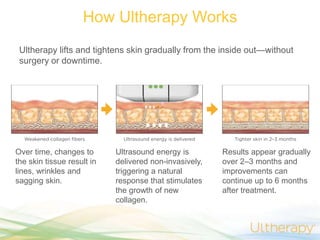 Ultherapy.slides | PPTX