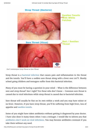 Swollen Tonsils With White Spots No Fever
