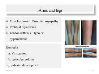ultimate to upload updated on 14september 2022 Thyroid examination.pptx
